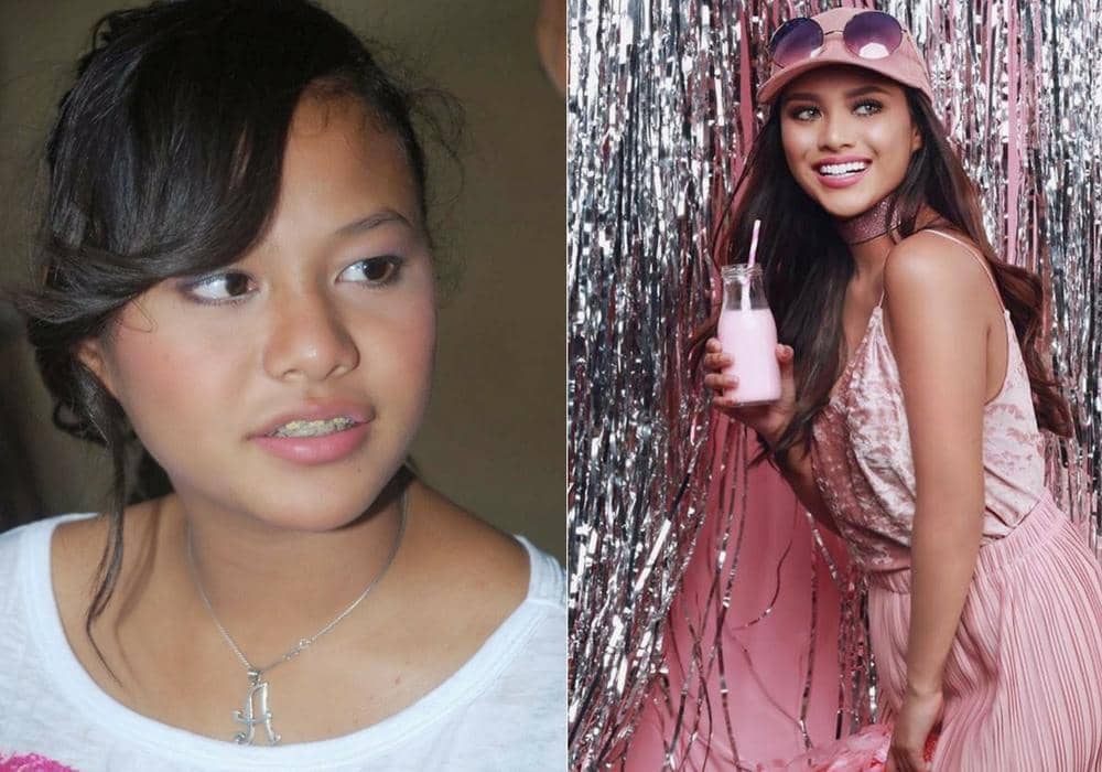 Pernah Gemuk, 5 Seleb Indonesia Ini Sukses Jadi Kurus | Popbela.com
