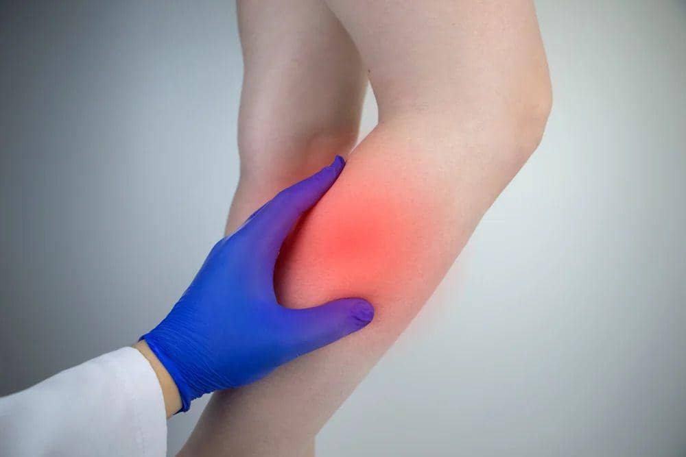 Phlebitis: Penyebab, Gejala, Diagnosis, Pengobatan | IDN Times